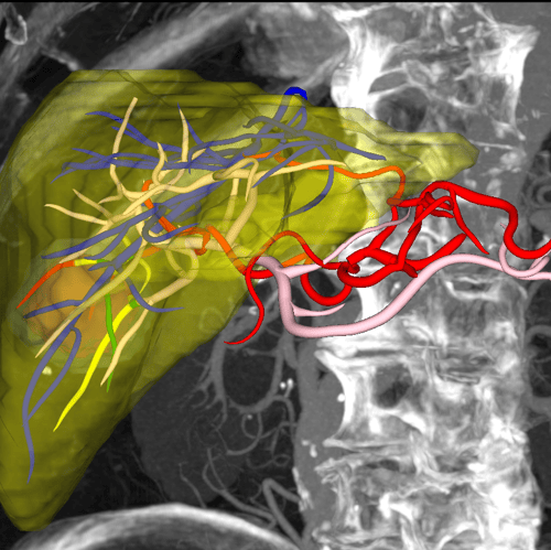About TeraRecon | Incredible Things Happen