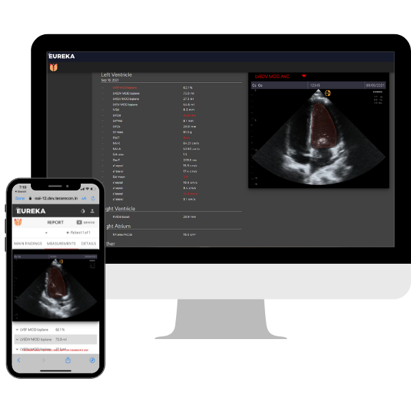 TCT 2023 Meeting Request | TeraRecon
