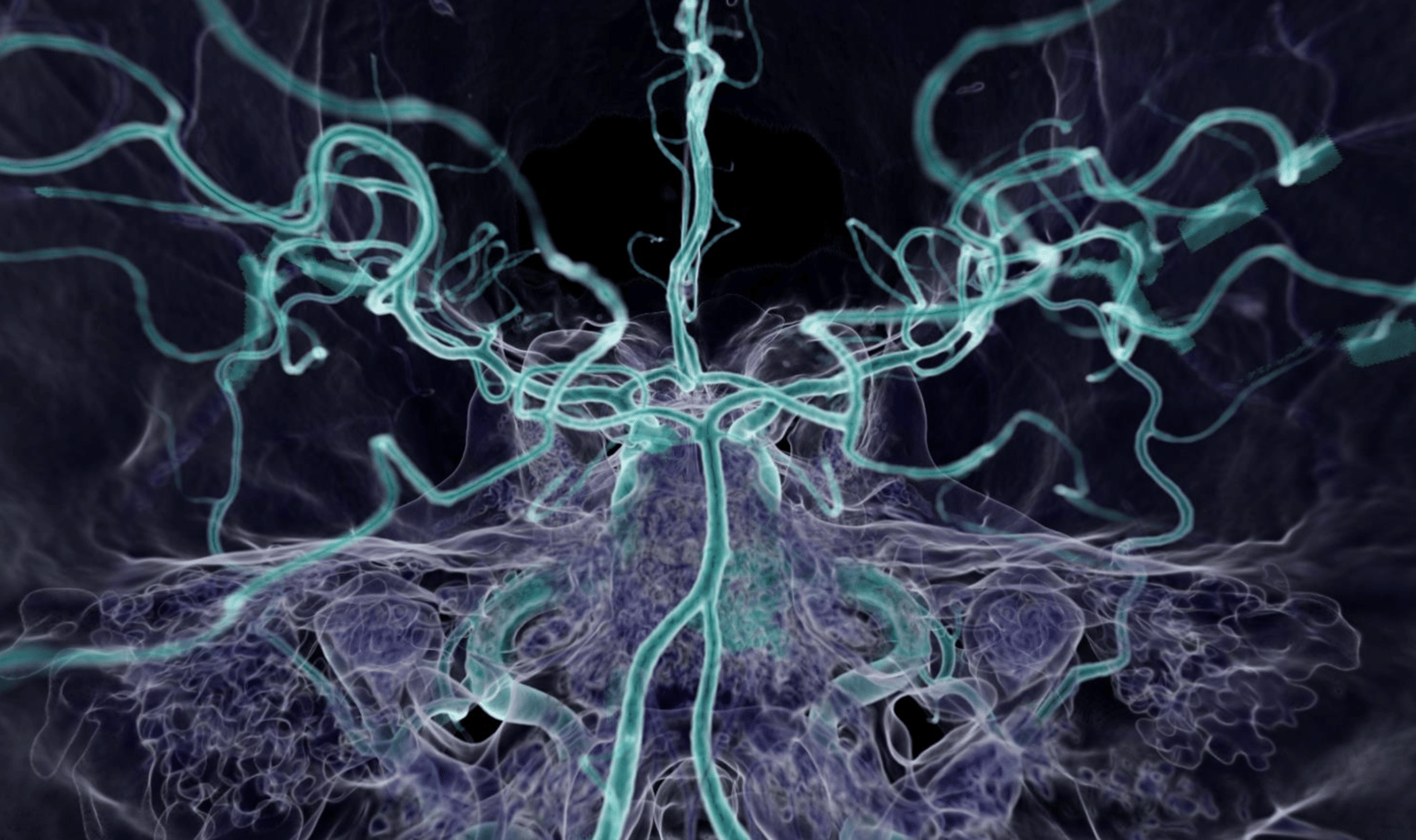 CT Head and Neck Advanced Visualization Package | Terarecon