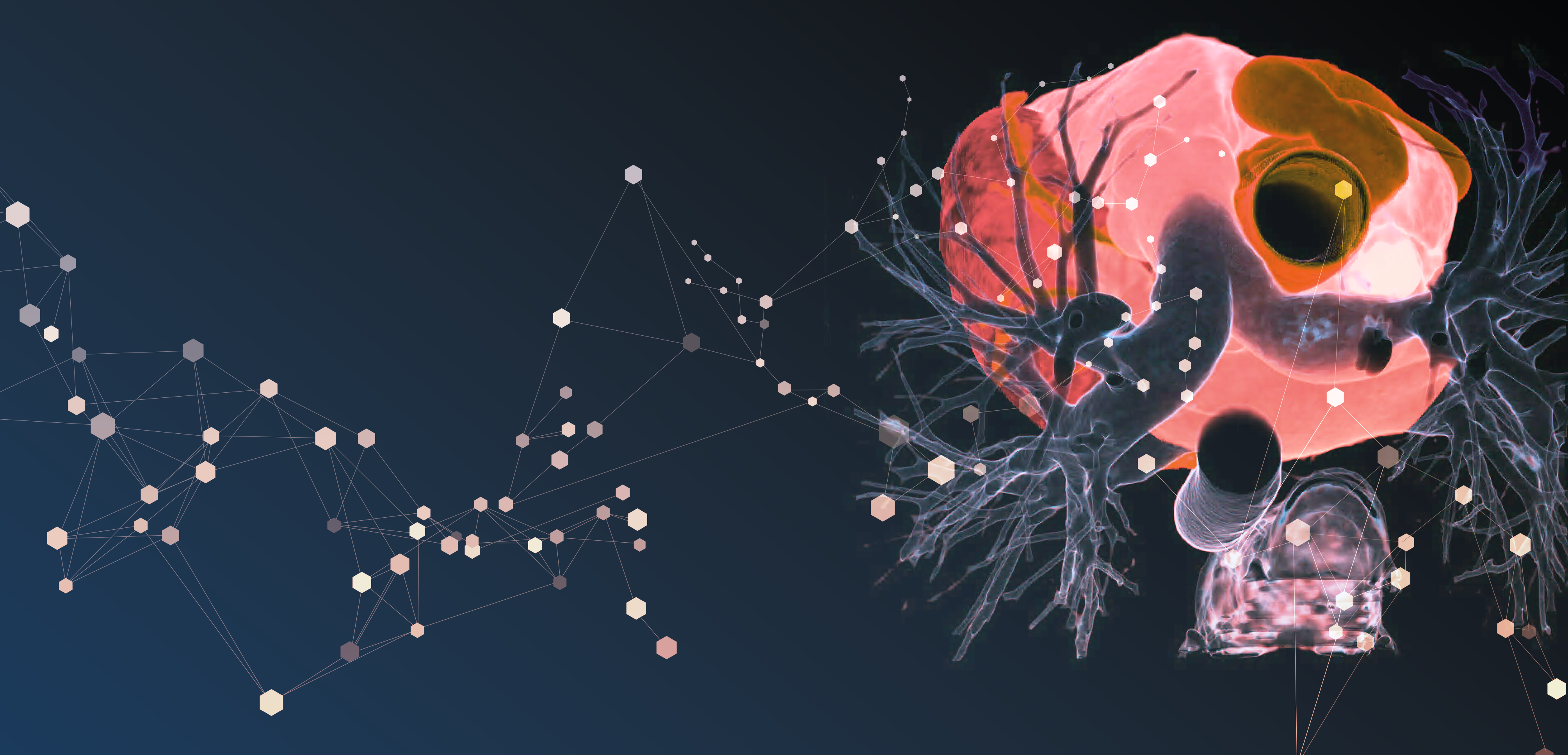 Eureka Clinical AI Consultation | TeraRecon