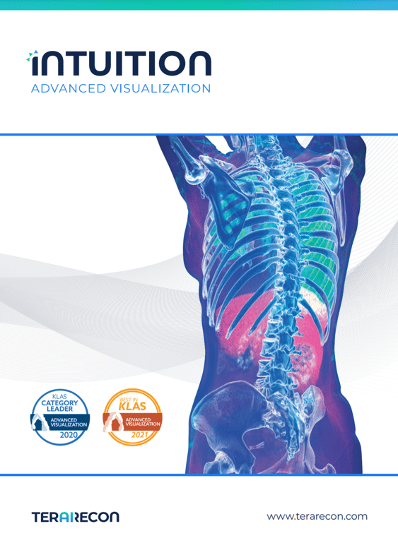 TeraRecon Intuition Brochure | Advanced Visualization