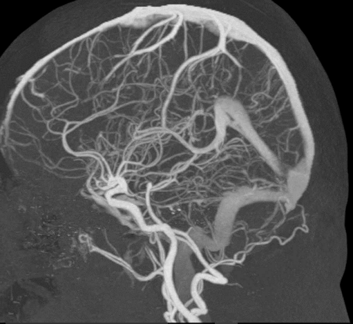 Traumatic Brain Injury (TBI) and Medical Imaging: New Methods and Tools