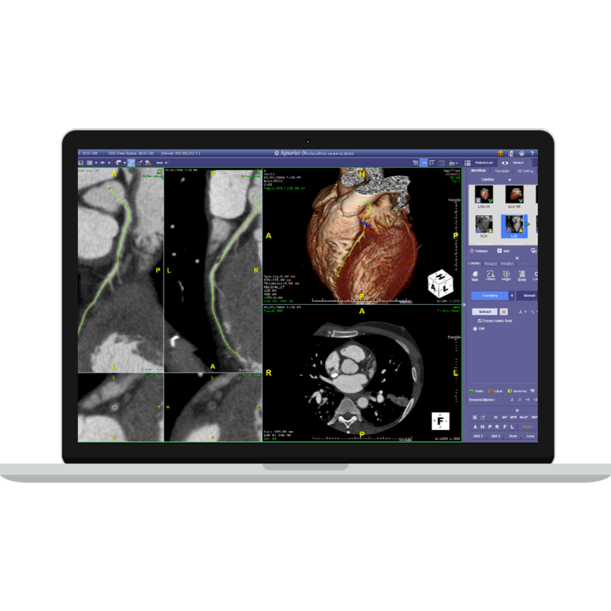 Medical Software Training Services | TeraRecon