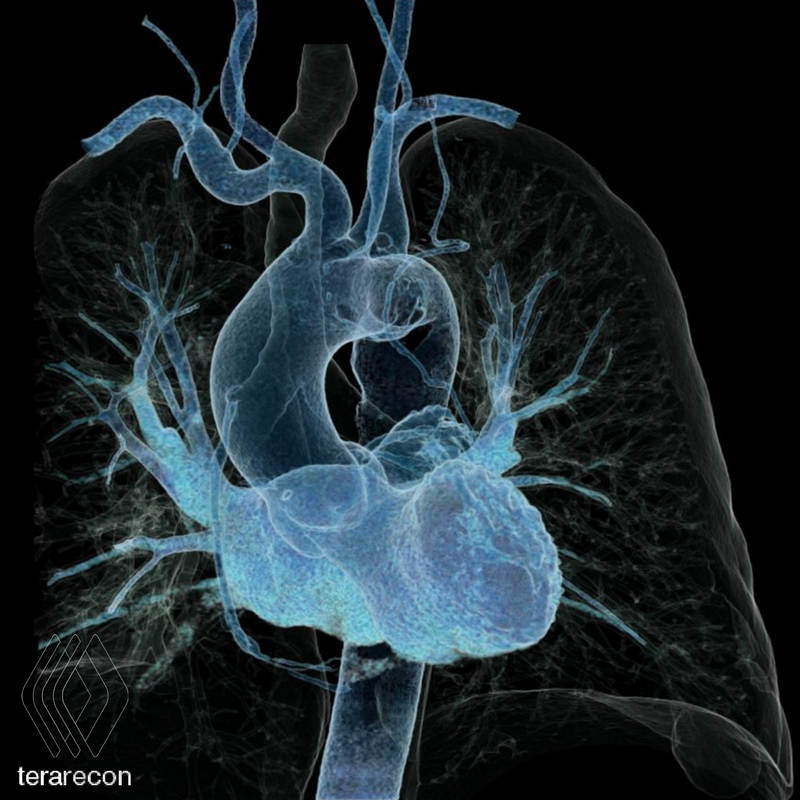 About TeraRecon | Incredible Things Happen