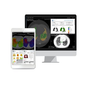 About TeraRecon | Incredible Things Happen