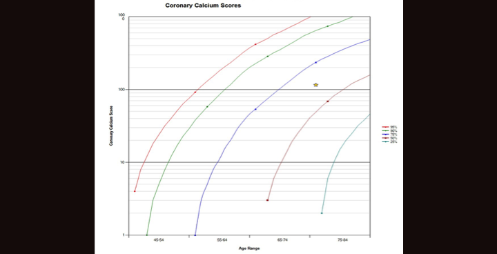 CT Cardiac Advanced Visualization Package | Terarecon