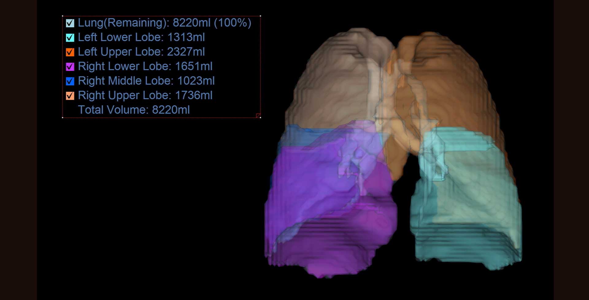 Lung Segmentation Advanced Visualization Package Lung Segmentation Advanced Visualization Package