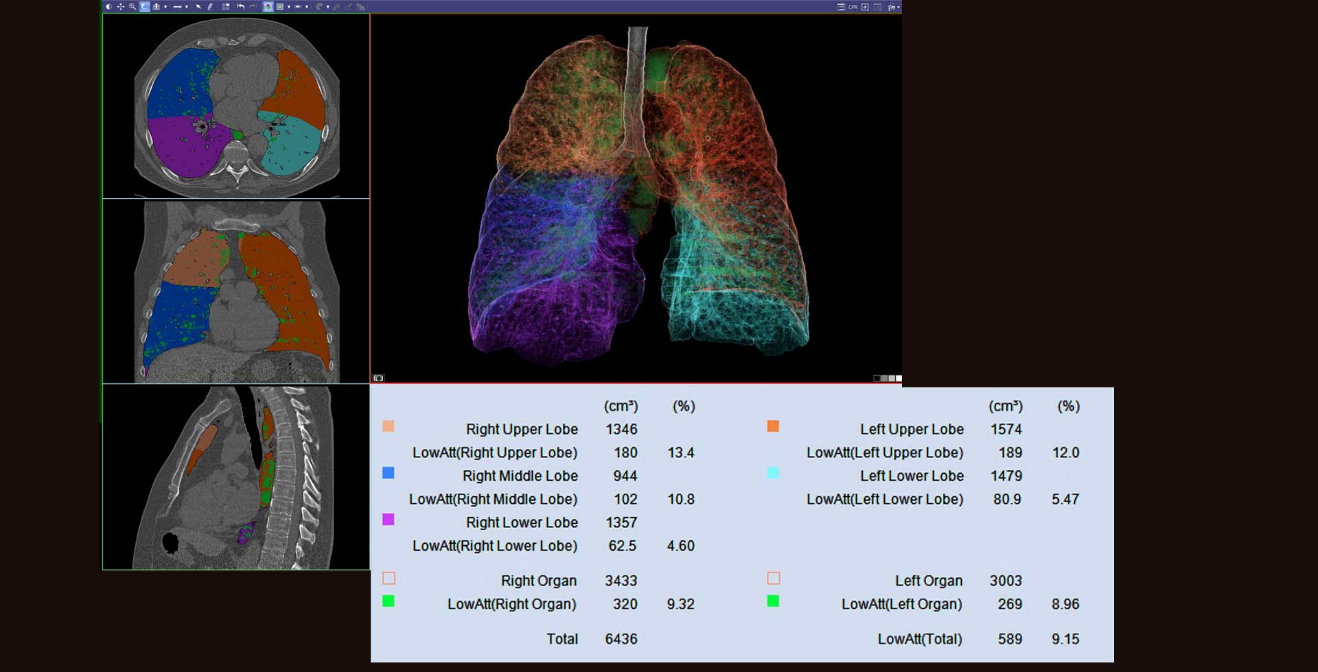 Lung Segmentation Advanced Visualization Package