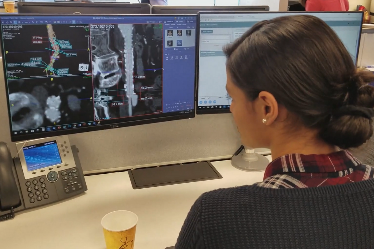 Premier Success | TeraRecon