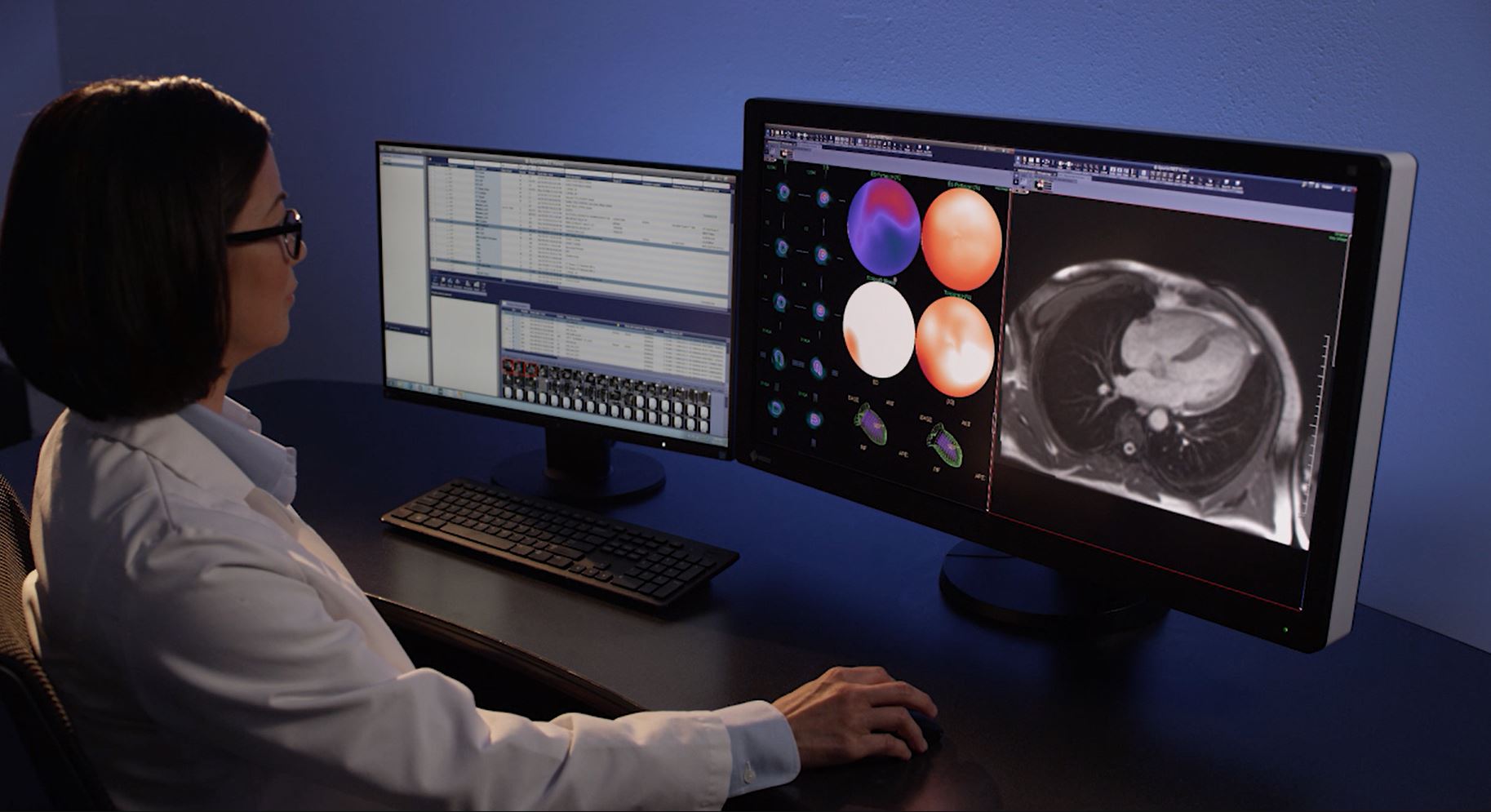 Medical Imaging Technical Support Services | TeraRecon