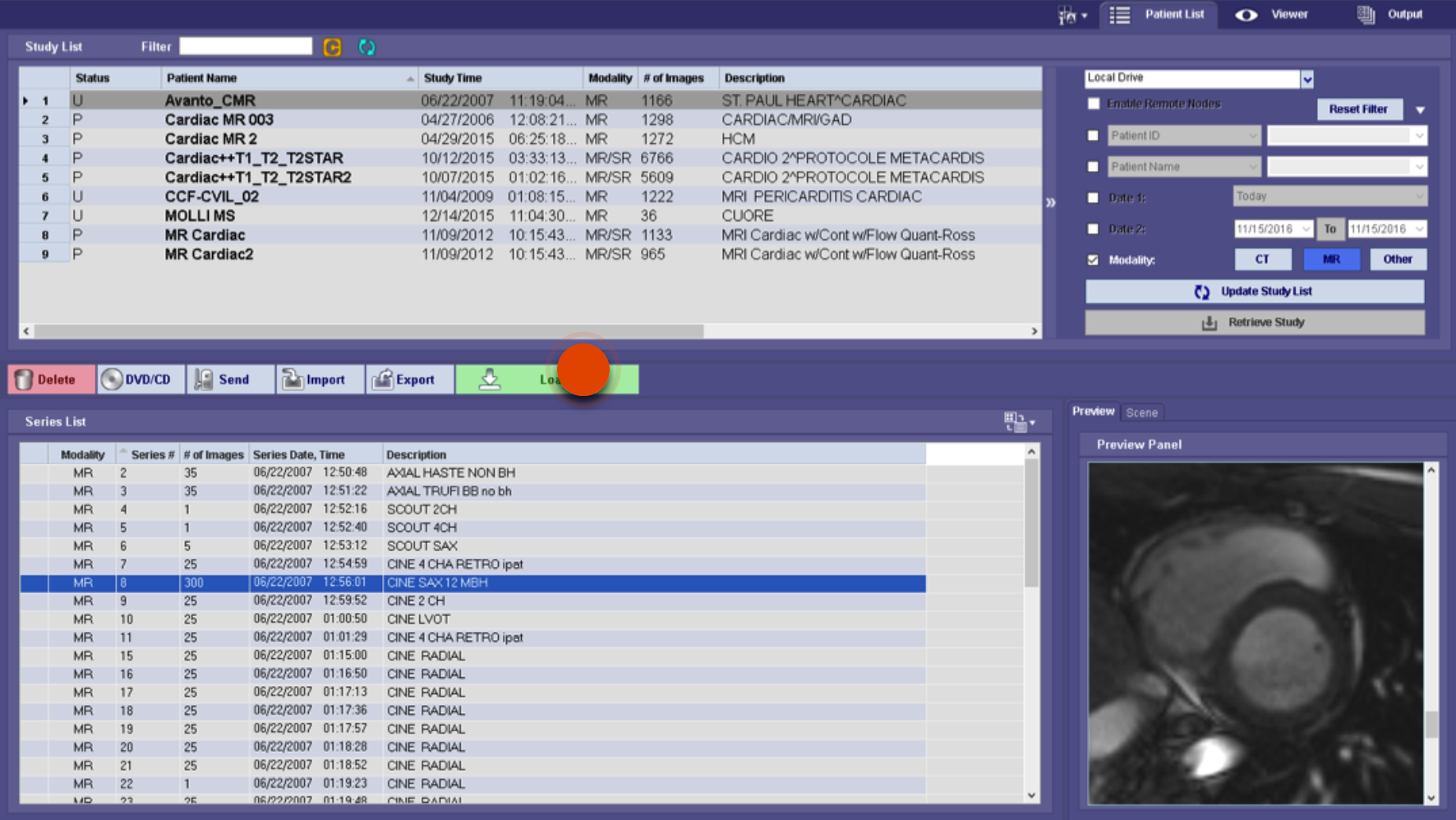 MR Cardiac Advanced Visualization Package | TeraRecon